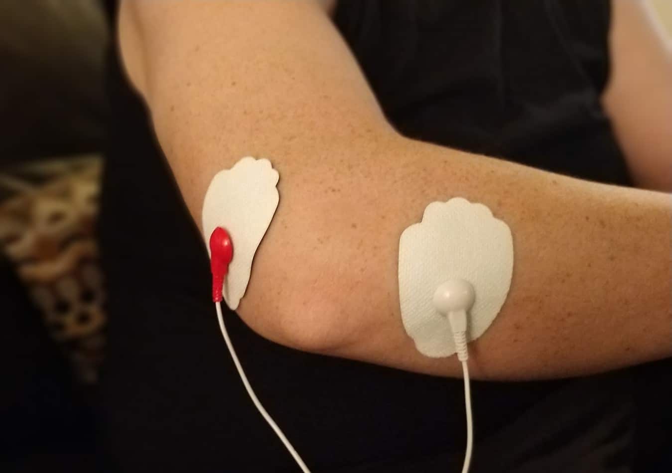 TENS unit placement for golfers elbow